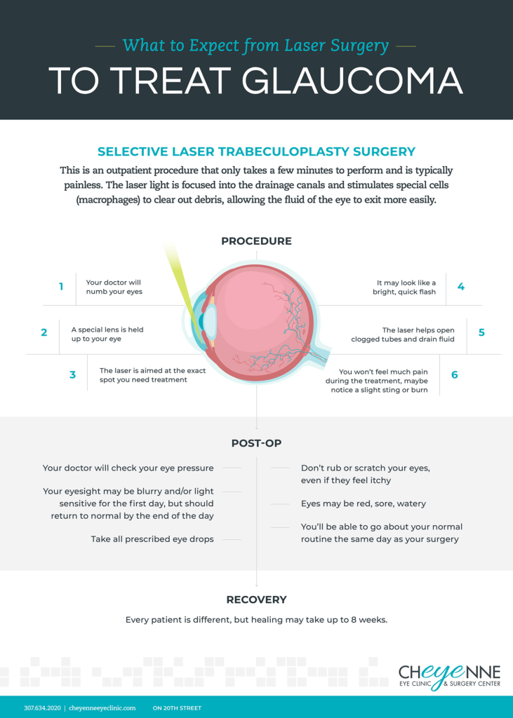 What to Expect from Laser Surgery to Treat Glaucoma
