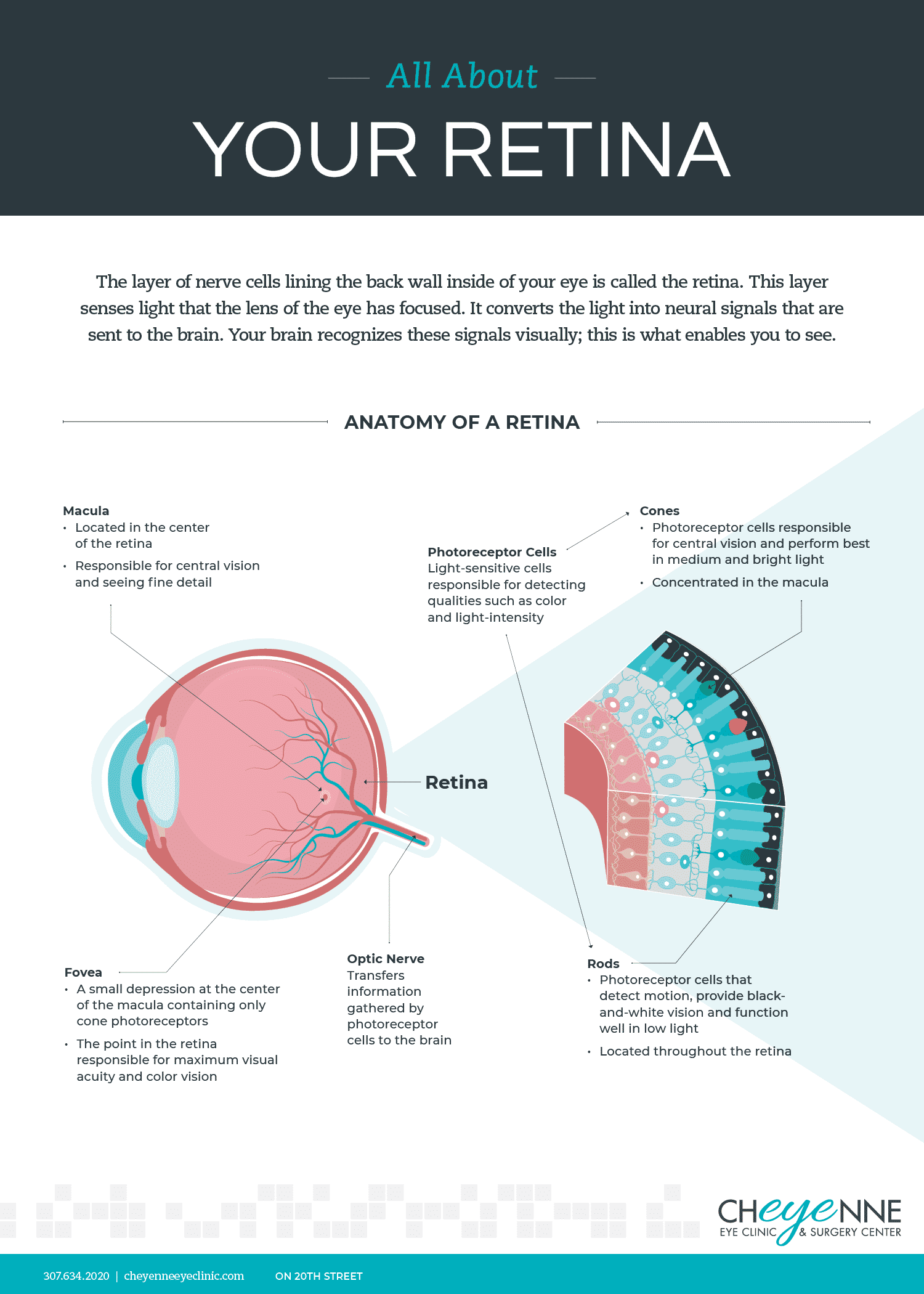 All About Your Retina - Cheyenne Eye Clinic & Surgery Center